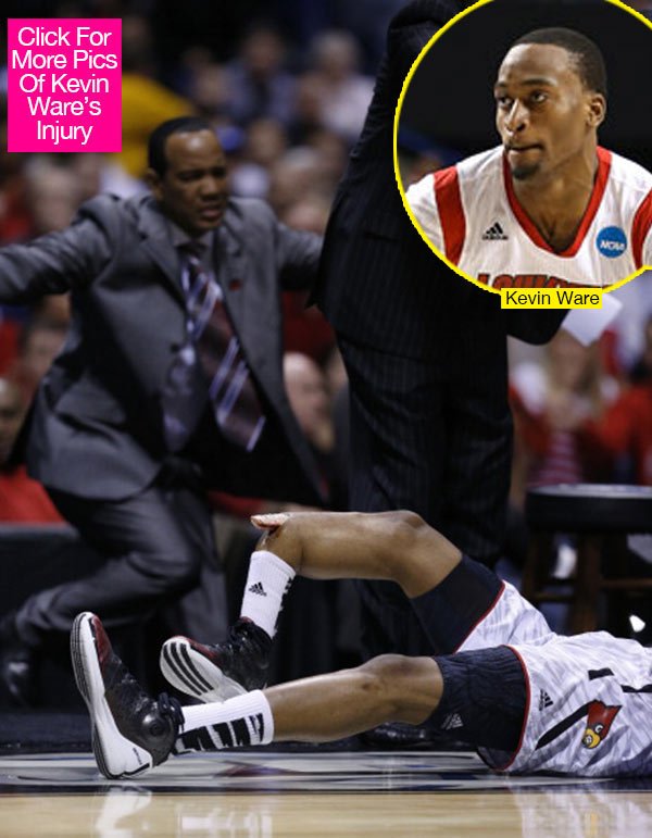 Kevin Ware: la espeluznante lesión que ha conmocionado al mundo (+Vídeo y fotos) | Rumberos